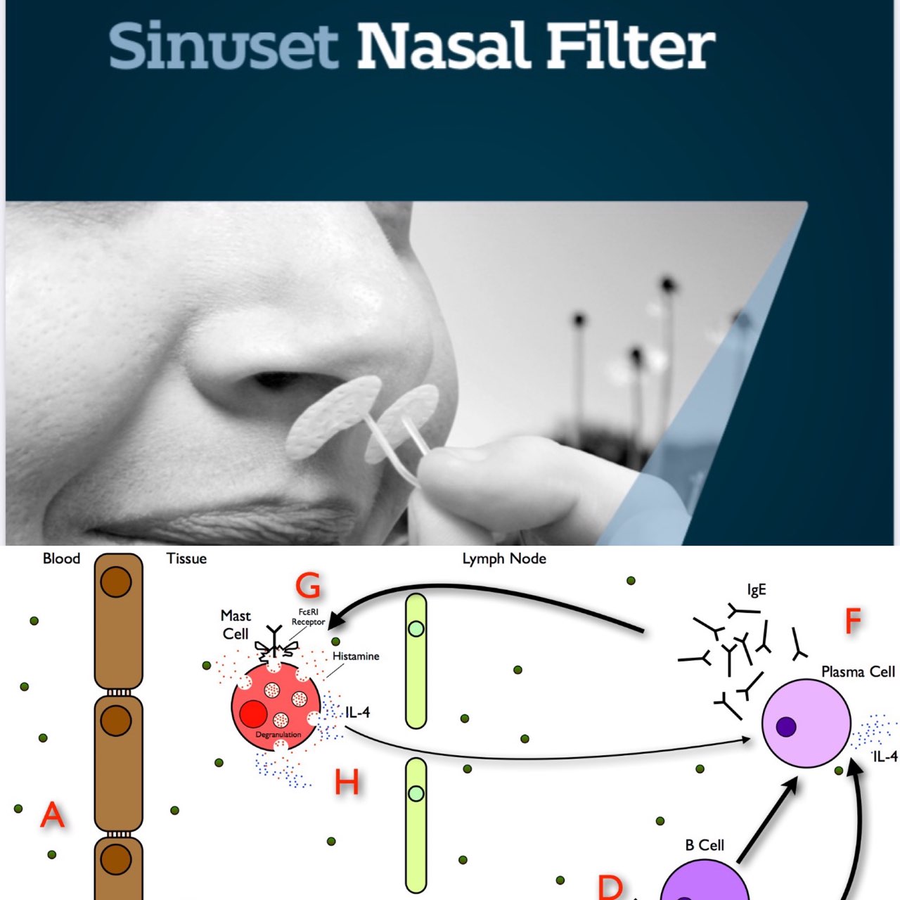 SINUSET NASAL FILTER – Ιατρικό Βήμα